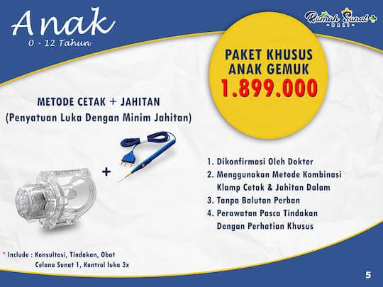 Paket Harga Sunat Modern & Aman untuk Usia Bayi, Anak dan Dewasa di Bali